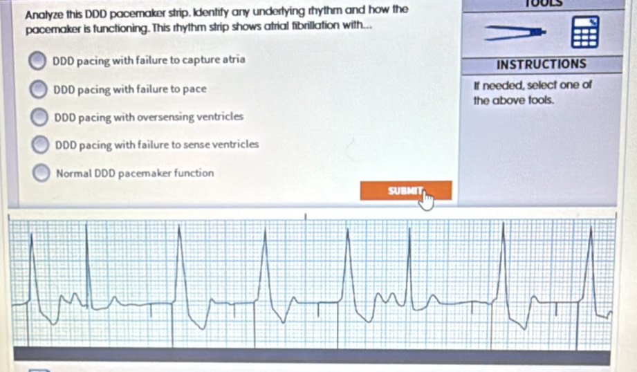 Solved: Analyze this DDD pacemaker strip. Identify any underlying ...