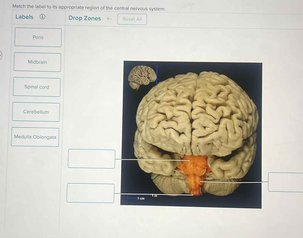 Solved: Match the label to its appropriate region of the central ...