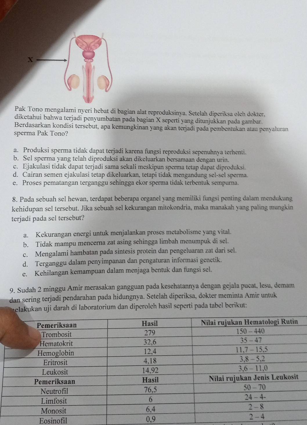 Telah dijawab:Pak Tono mengalami nyeri hebat di bagian alat ...