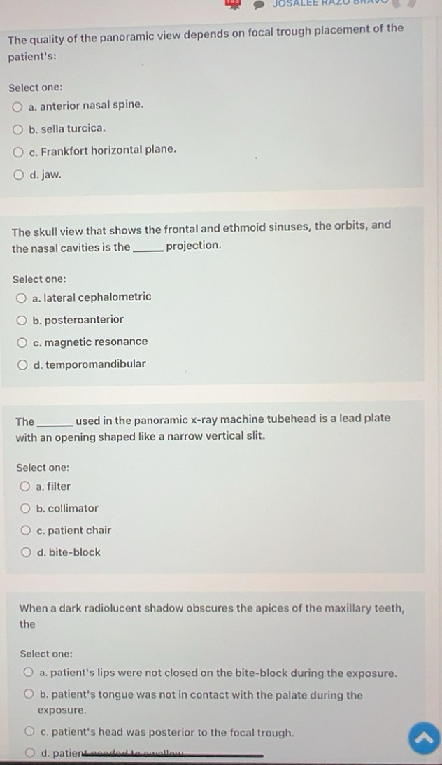 Solved: The quality of the panoramic view depends on focal trough ...