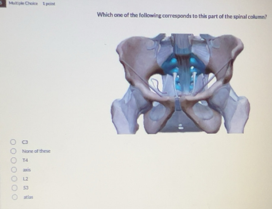 Solved: Multiple Chaice 1 point Which one of the following corresponds ...