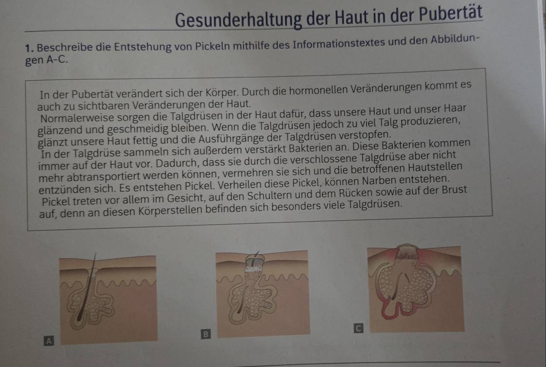 Gelöst:Gesunderhaltung der Haut in der Pubertät 1. Beschreibe die ...