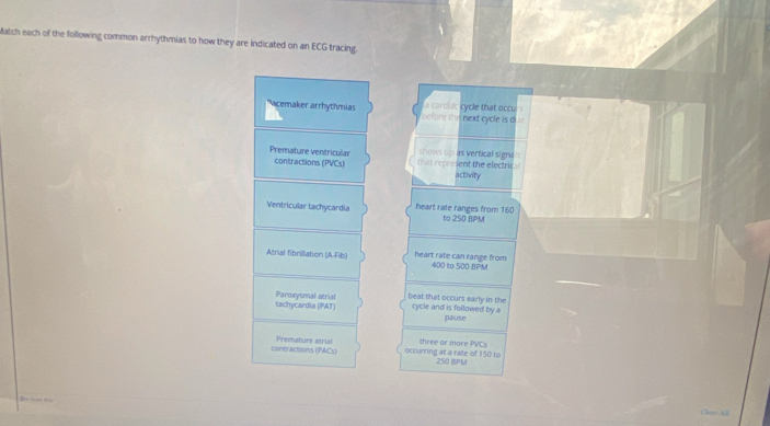 Solved: Match each of the following common arrhythmias to how they are ...