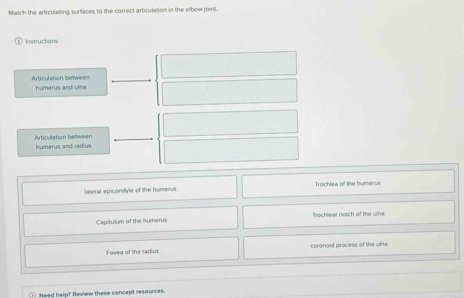 Solved: Match the articulating surfaces to the correct articulation in ...