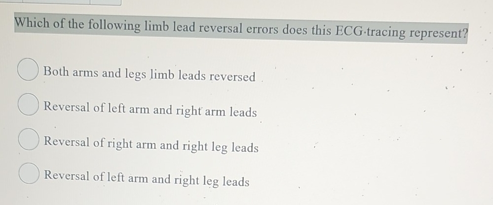 Solved: Which of the following limb lead reversal errors does this ECG ...