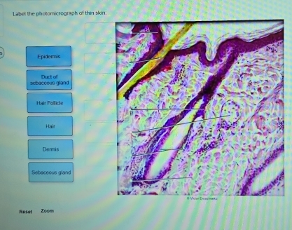 Solved: Label the photomicrograph of thin skin. Epidemis sebaceous ...
