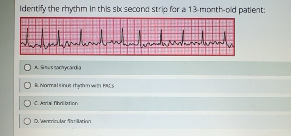 Solved: Identify the rhythm in this six second strip for a 13-month ...