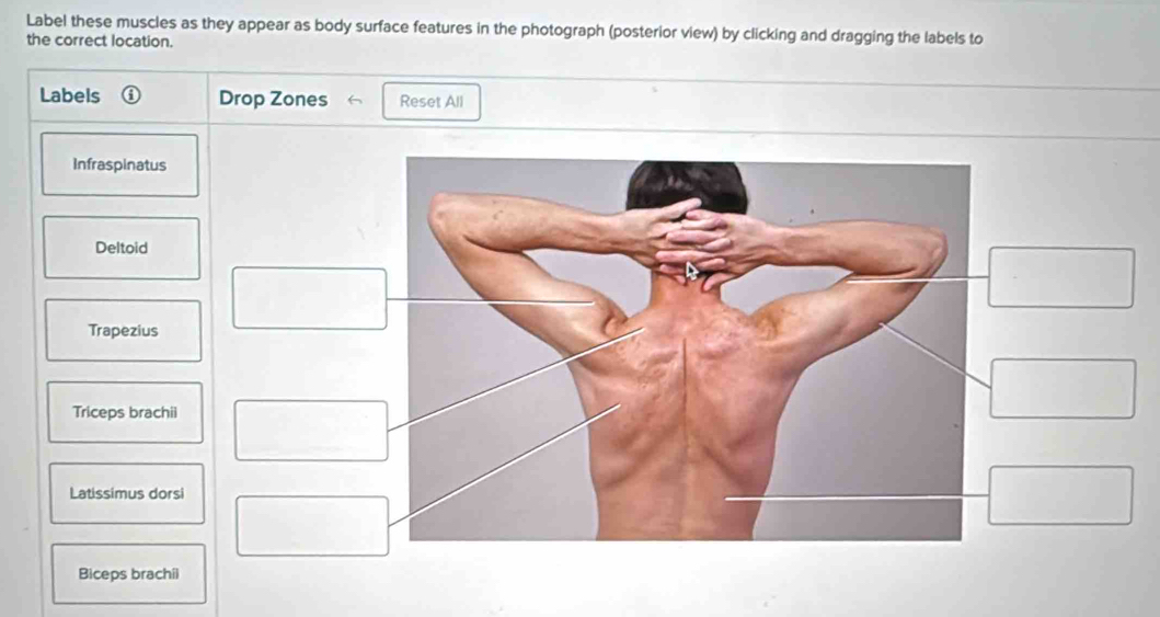 Solved: Label these muscles as they appear as body surface features in ...