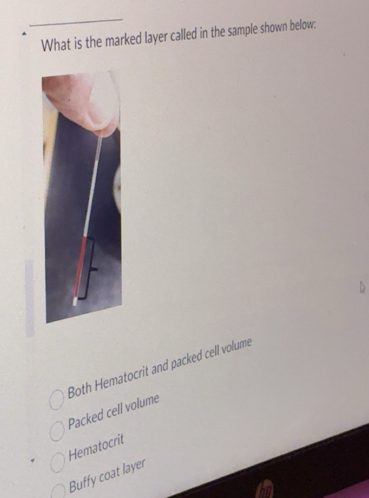 Solved: What is the marked layer called in the sample shown below: Both ...