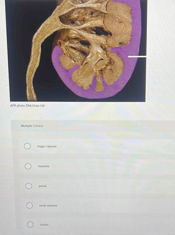 Solved: major calyxes medulla pelvis renal sinuses cortex [Biology]