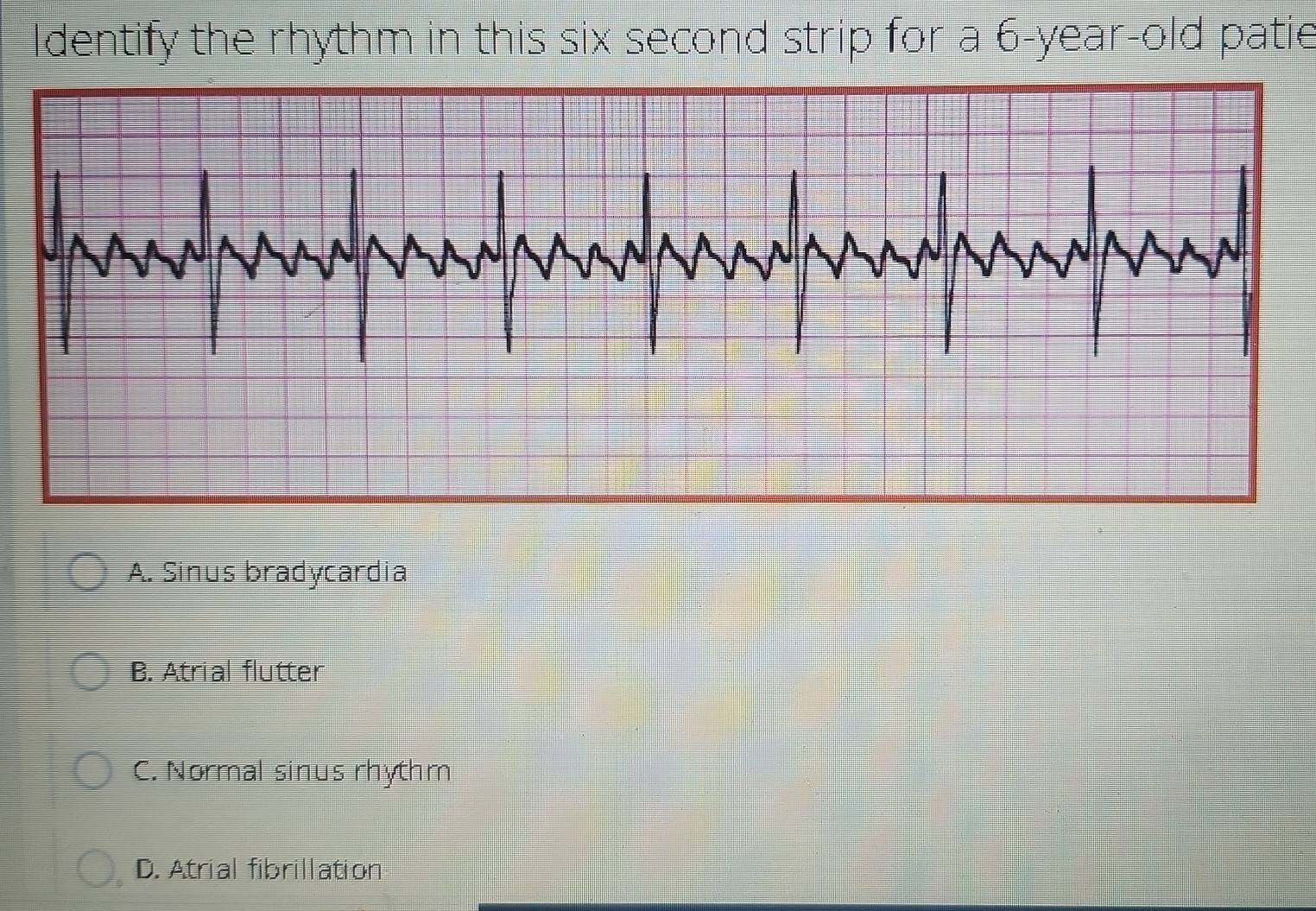 Solved: Identify the rhythm in this six second strip for a 6-year-old ...