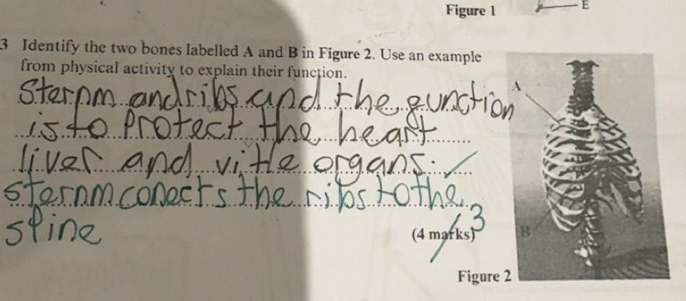 Solved: Figure 1 E 3 Identify the two bones labelled A and B in Figure ...