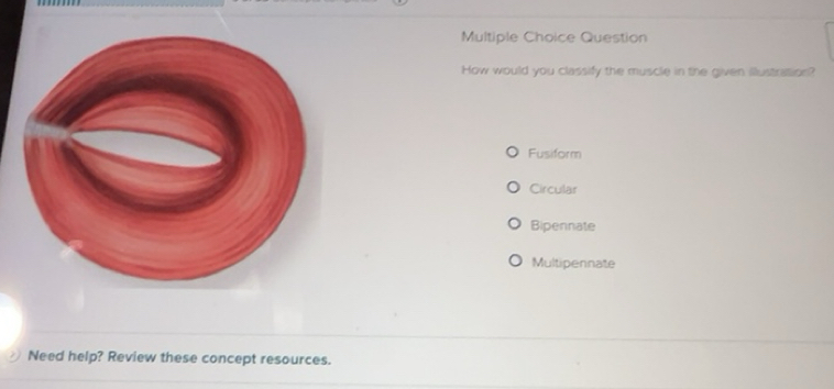 Solved: Question How would you classify the muscle in the given ...