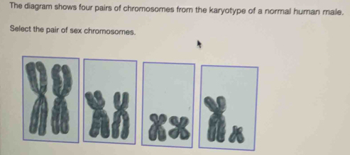 Solved: The diagram shows four pairs of chromosomes from the karyotype of a normal human male ...