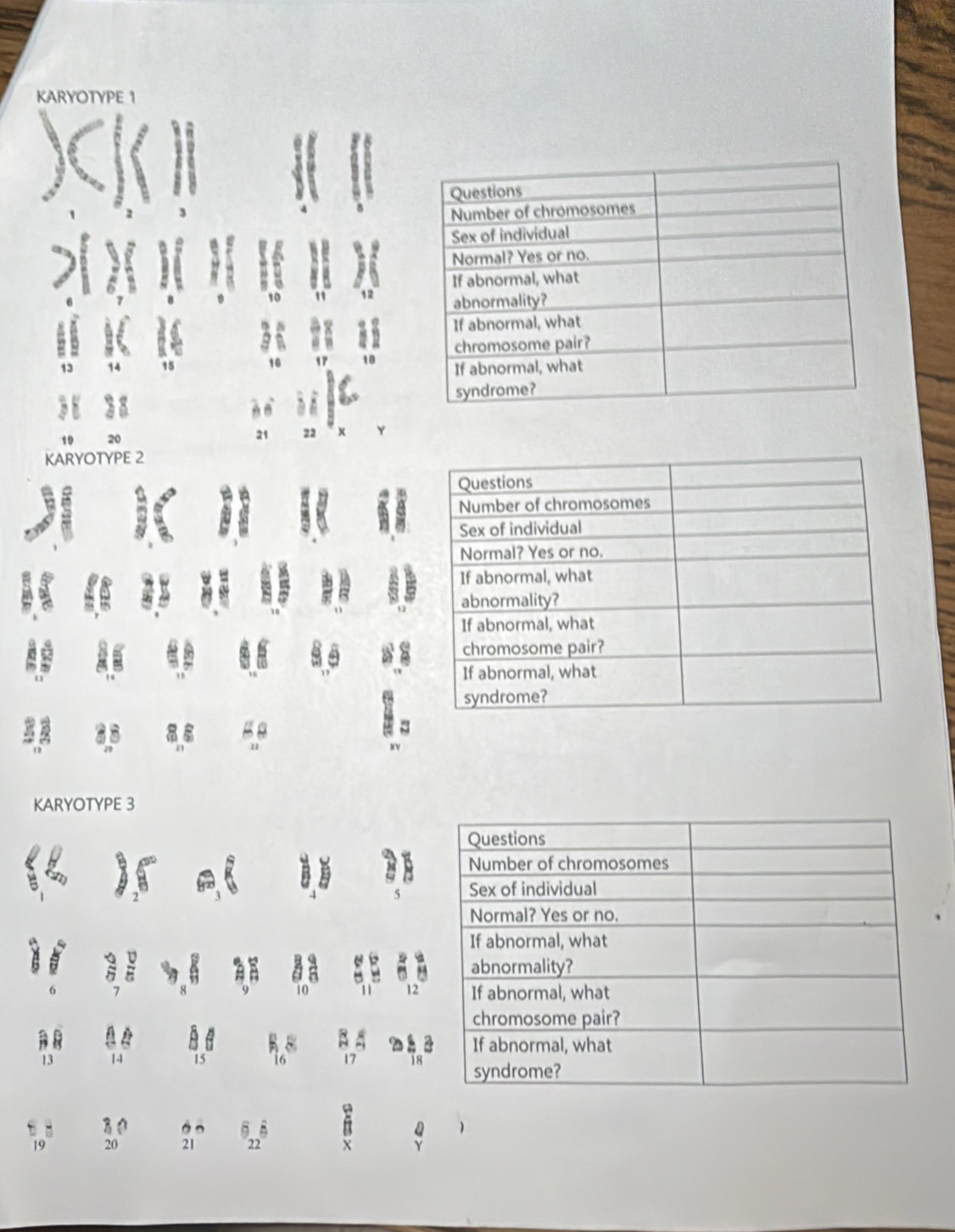 Solved: KARYOTYPE 1 KARYOTYPE 3 12 20 21 X [Biology]