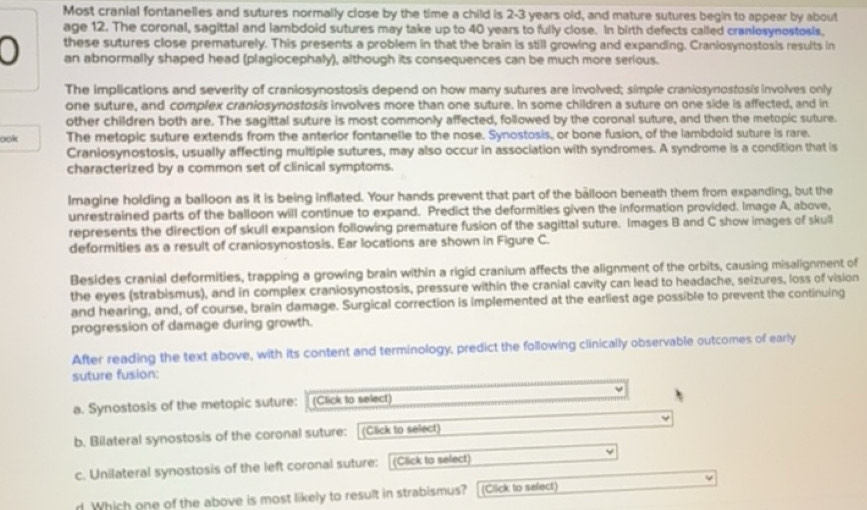 Solved: Most cranial fontanelles and sutures normally close by the time ...