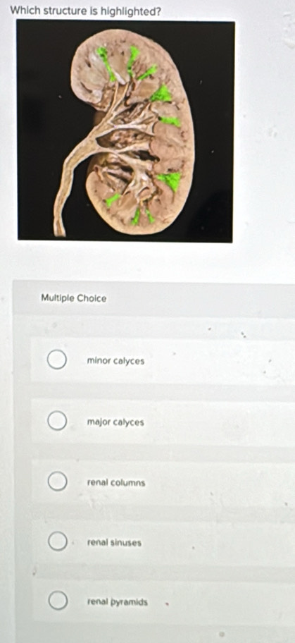 Solved: Which structure is highlighted? Multiple Choice minor calyces major calyces renal ...