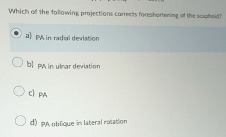 Solved: Which of the following projections corrects foreshortening of ...