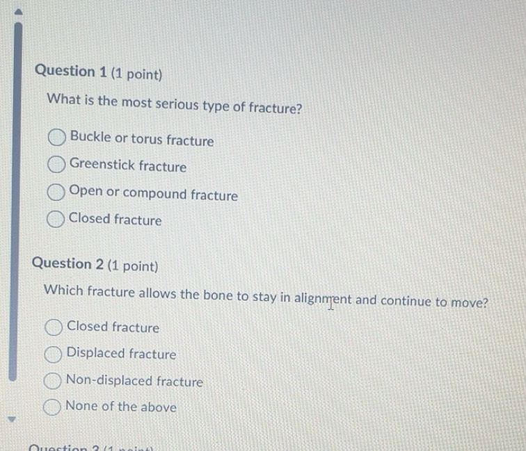 Solved: What is the most serious type of fracture? Buckle or torus ...