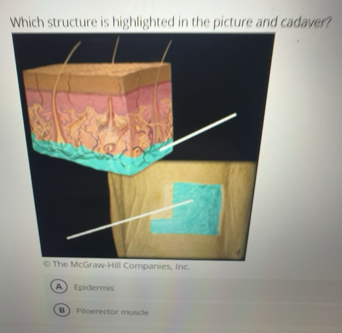 Solved: Which structure is highlighted in the picture and cadaver? A ...