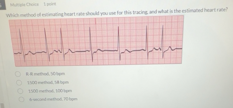 Solved: Which method of estimating heart rate should you use for this ...
