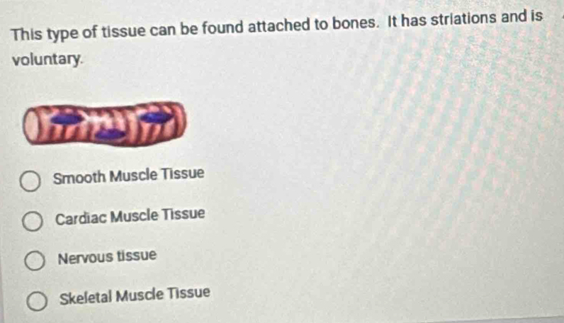 Solved: This type of tissue can be found attached to bones. It has ...