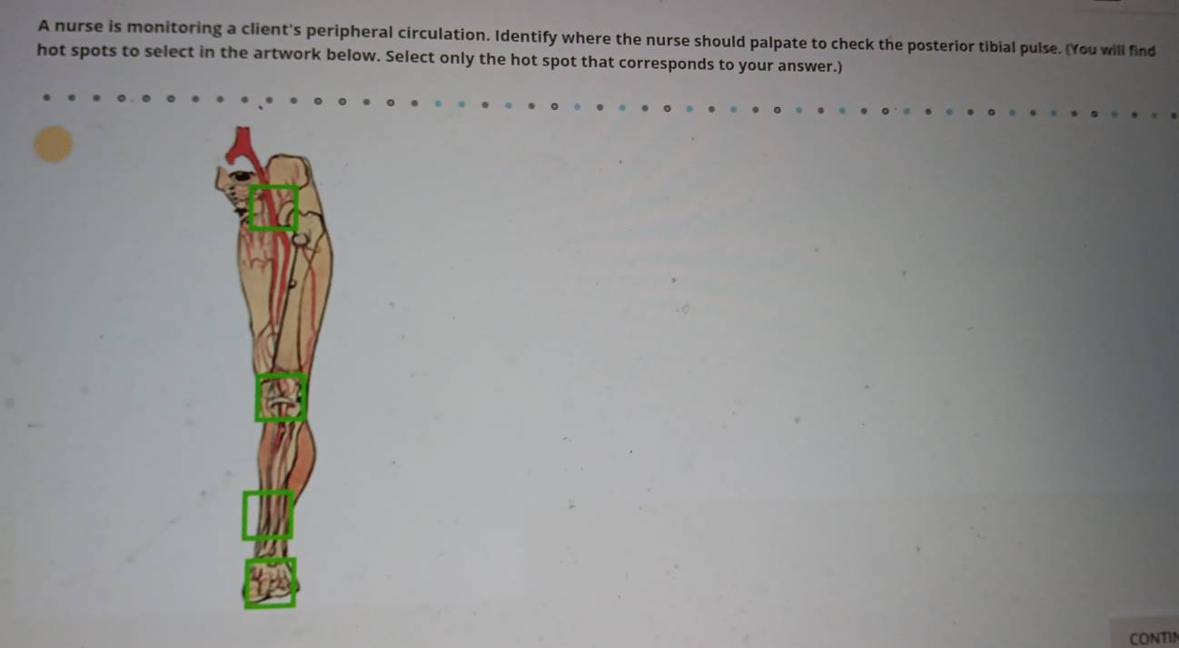 Solved: A nurse is monitoring a client's peripheral circulation ...