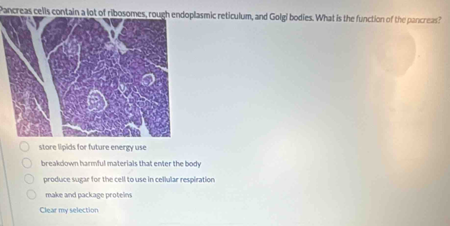 Solved: Pancreas cells contain a lot of ribosomes, rough endoplasmic ...
