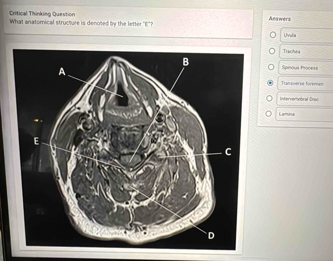 Solved: Critical Thinking Question What anatomical structure is denoted ...
