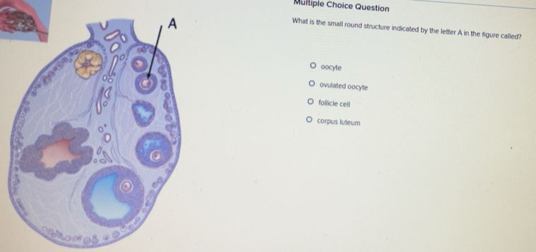 Solved: Question What is the small round structure indicated by the ...