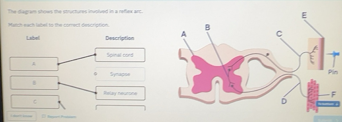 Solved: The diagram shows the structures involved in a reflex arc ...