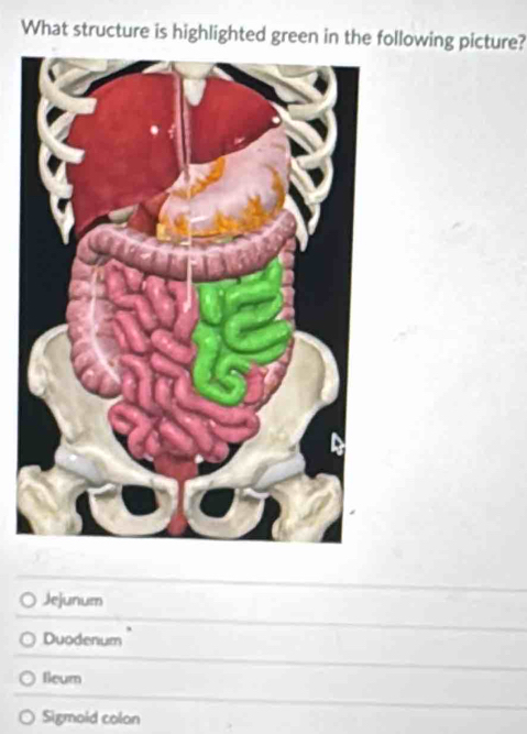 Solved: What structure is highlighted green in the following picture ...