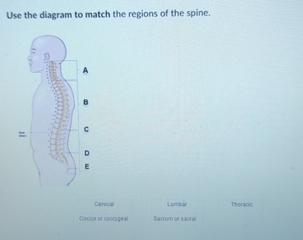 Solved: Use the diagram to match the regions of the spine. Cervical ...
