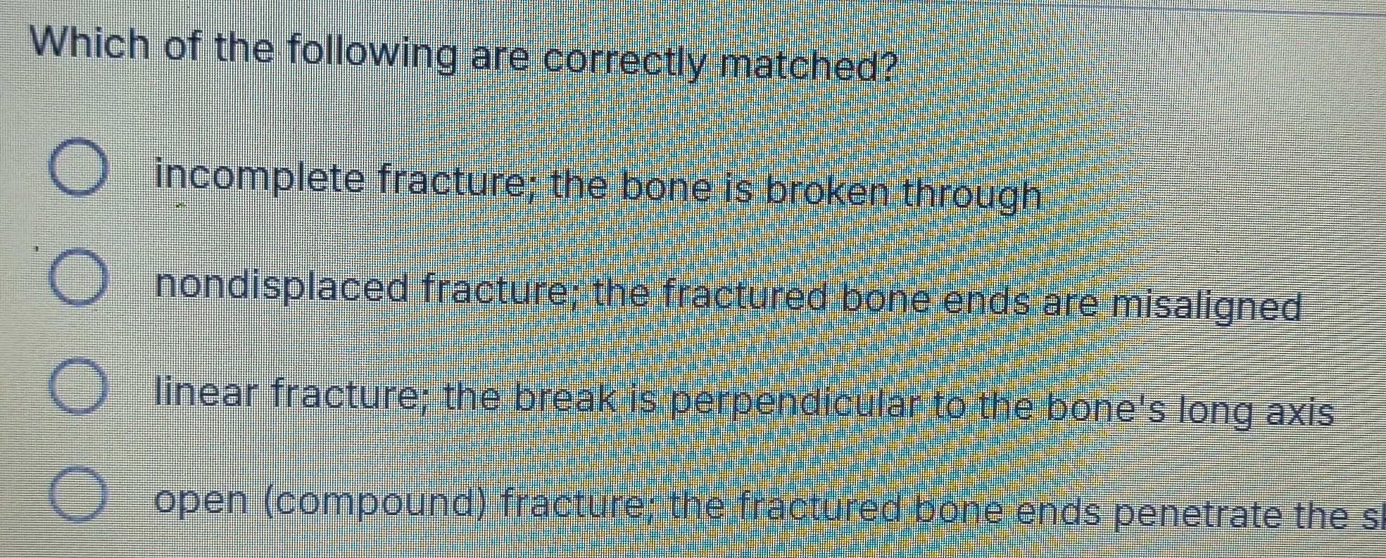 Solved: Which of the following are correctly matched? incomplete ...