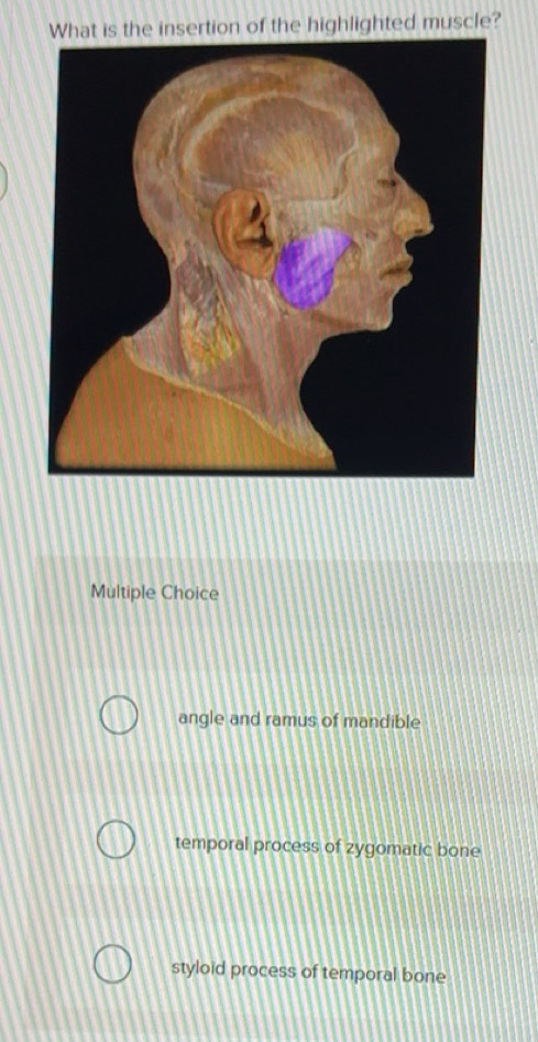 Solved: ertion of the highlighted muscle? Multiple Choice angle and ...
