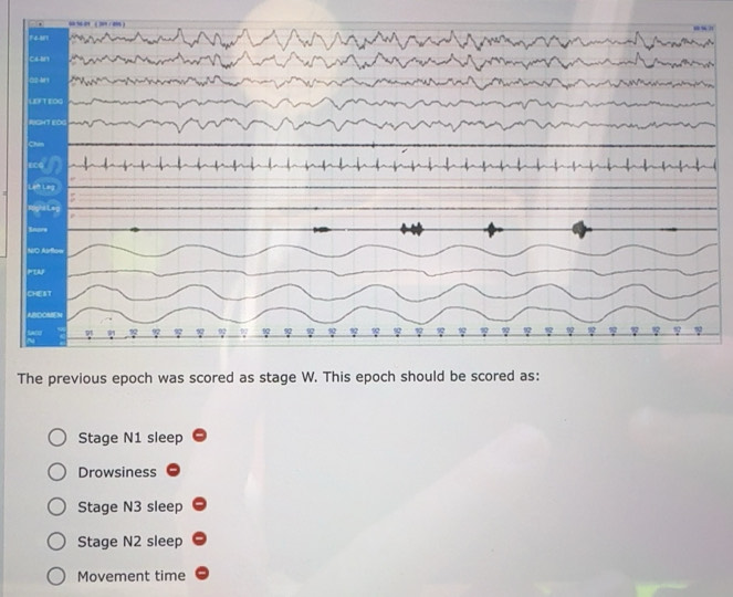 Solved: The previous epoch was scored as stage W. This epoch should be ...